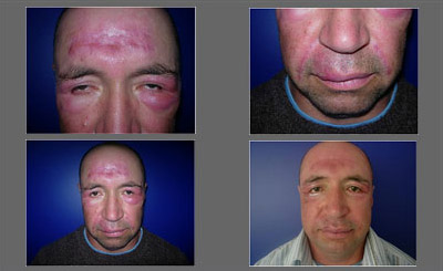 Cirugías Reconstructivas | Dr Daniel Manrique